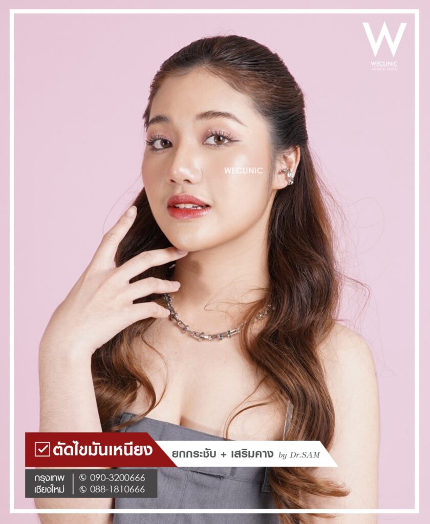 รวมรีวิวเคสผ่าตัดจมูก คาง ปาก ตา คลินิกศัลยกรรม WE Clinic
